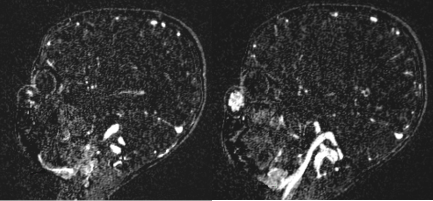 Radiology Manipal Hospital